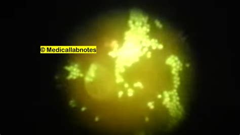 Candida Introduction Morphology Pathogenicity Lab Diagnosis