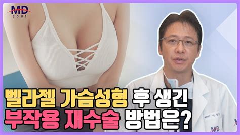 벨라젤 가슴성형 후 생긴 구형구축 부작용 가슴 보형물 교체로 해결 Youtube