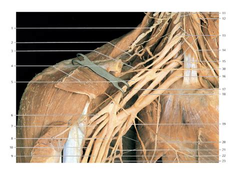 Brachial Plexus Diagram Quizlet