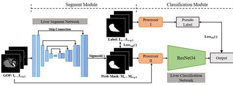 GitHub ChuiZhao Liver Segmentation And Classification My Graduation Project In Nanjing University
