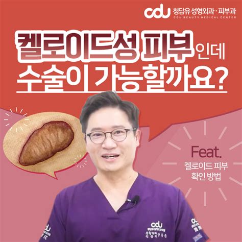 켈로이드 피부 성형수술 가능할까요 네이버 블로그