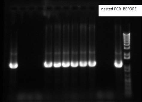Questions With Answers In NESTED PCR Scientific Method