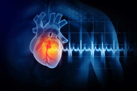 Diagnosis And Management Of Acute Coronary Syndrome
