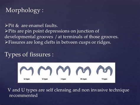 Pit And Fissures