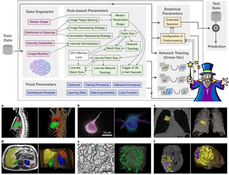 The Ultimate Guide To Medical Image Segmentation With Deep Learning 2d And 3d