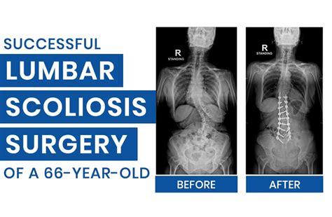 Best Medical Tourism Services In India Cureindia