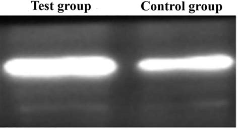 Expression Of Hla Ii Protein In Peripheral Blood B Lymphocytes