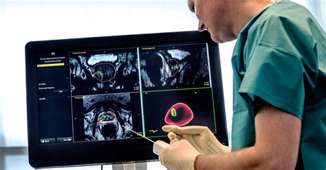 Qué Es El Bloqueo Radicular El Tratamiento Para La Hernia De Disco Que Le Harán A Alberto