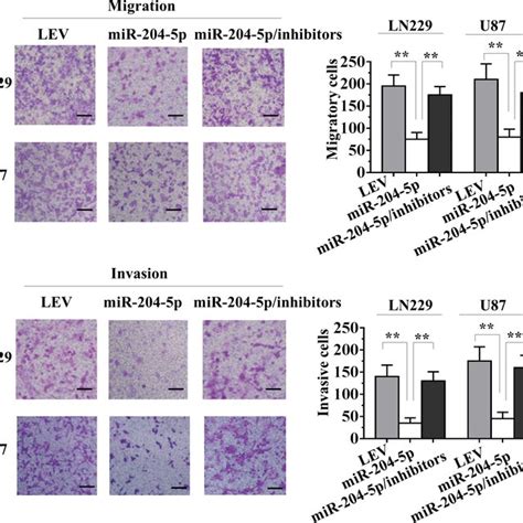 Mir 204 5p Is Downregulated In Glioma Tissues A Decreased Levels Of
