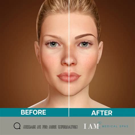 I Am Medical Spas And Laser Centers On Linkedin Its The Perfect Time