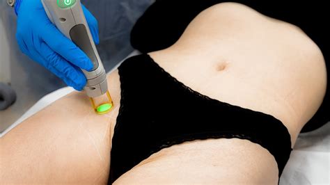 Bikini Laser Hair Removal Hollywood Brazilian And More Youtube