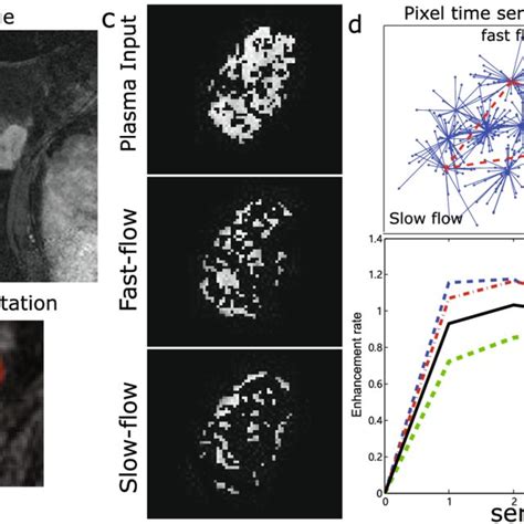 Example Of Cam Applied To A A Breast Image B Segmented Tumour Image C