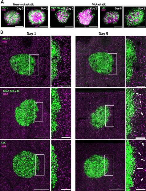 Evaluation Of The Metastatic Potential Of 3d Bioprinted Tumor Stroma