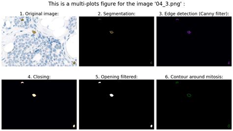 Automated Mitosis Detection And Analysis In Histological Images Using