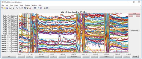 Preprocessing And Averaging Of Multi Channel Nirs Data Fieldtrip Toolbox
