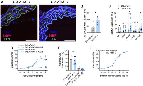 Figure 3 From Reduction Of Double Strand Dna Break Repair Exacerbates