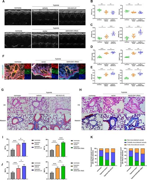 SIKs Inhibition Or Specific Smooth Muscle SIK1 Knockdown Aggravated PAH