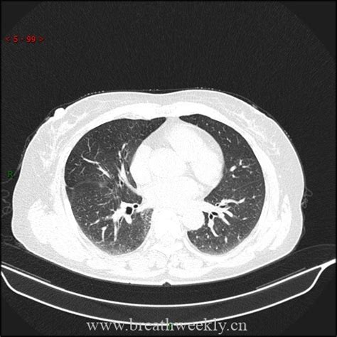 呼吸影像 每周呼吸 每周呼吸