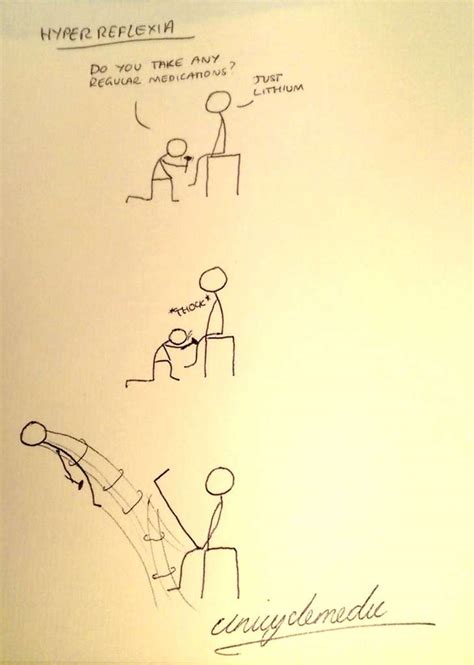 Lithium Side Effects Unicyclemedic