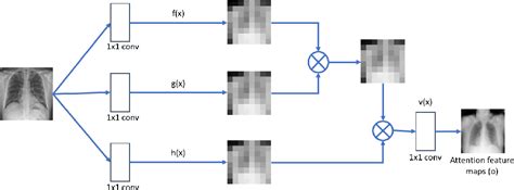 Figure 2 From A Self Attention Guided Multi Scale Gradient Gan For Diversified X Ray Image