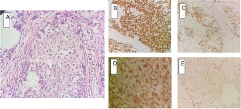 Histopathological Staining And Immunohistochemical Stain Of Peritoneal