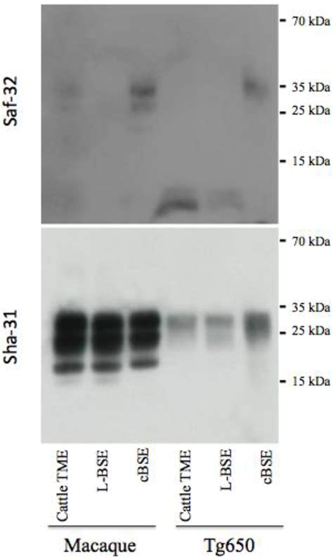Pathogens Special Issue Prions