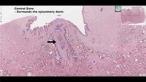 Efferent Ductules Histology