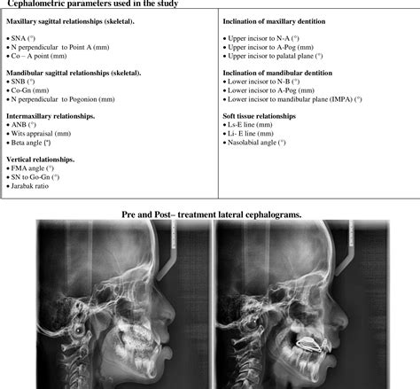 A Cephalometric Evaluation Of Skeletal Dental And Soft