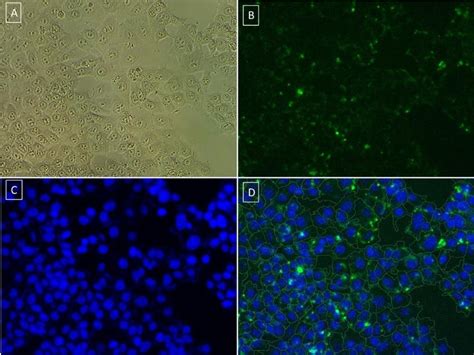 Fluorescent Imaging Of A 431 Cells Treated With Fitc Conjugated