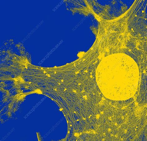 Cytoskeleton Tem Stock Image C009 9282 Science Photo Library