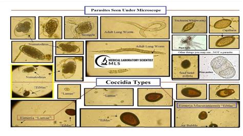 Parasites In Stool Microscope