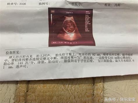 孕媽順產歸來，二胎又是臭小子，兒女雙全夢破滅！ 每日頭條