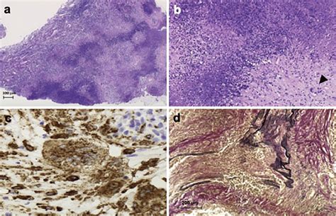 Figure6pituitary Biopsy Results Pituitary Sections Under Light