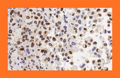 Validation Designed For Your Needs Abcam