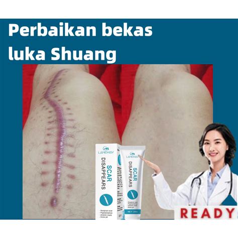 Jual Salep Penghilang Bekas Luka Menghilangkan Bekas Luka Lepaskan Bekas Luka Gigitan Nyamuk