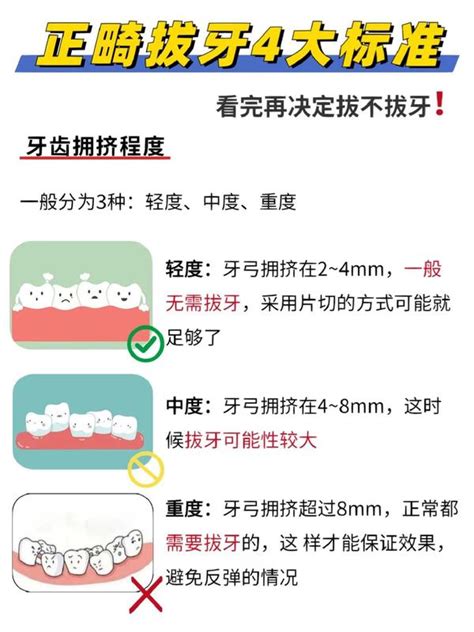 正畸拔牙4大标准请仔细阅读 知乎