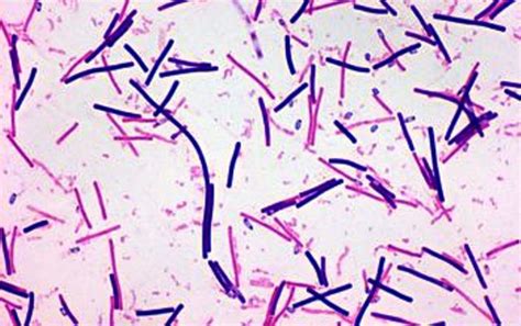 Clostridium Difficile Magazine Science