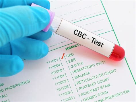 CBC Blood Test Preparation And Procedure GetHow