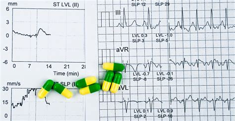 Ekg 또는 Ecg 결과 그리고 녹색 노란 캡슐 알 약 심장에 대 한 프로 모션 패키지 수석 또는 노인 사람들이 개념 확인