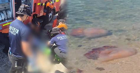 물놀이사고 절반은 8월에…해파리 쏘임 사고도 급증