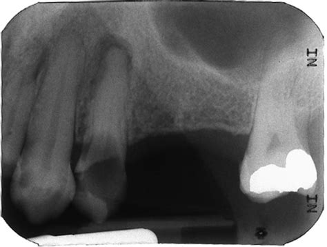 Anatomy Monday Nasolabial Fold Soft Tissue Dr Gs Toothpix