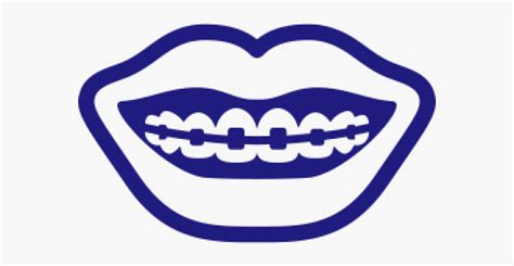 Free Braces Cliparts Download Free Braces Cliparts Png Images Free