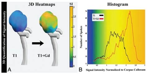 Visual Assessment Of Aneurysm Wall Enhancement Is Prone To Variability