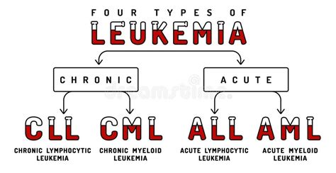 Four Types Of Leukemia Acute Myeloid Chronic Lymphocytic Type Stock Vector Illustration Of