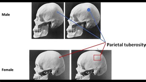 Skull Male Vs Female