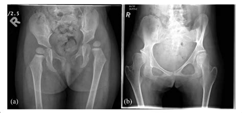 Radiographs Used To List And Rank Radiographic Parameters Qualitative