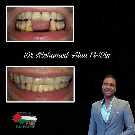 Drmohamed Alaa El Din Dental Clinic Alexandria