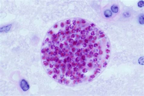 Discover More In Toxoplasmosis On Flipboard