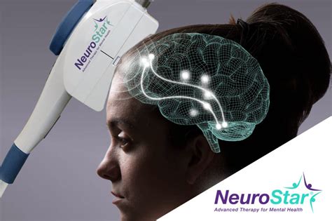 Tms Therapy For Treatment Of Depression Melbourne Fl Neurostar Tms