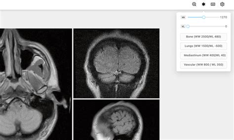 Active Learning For Machine Learning And Computer Vision Encord
